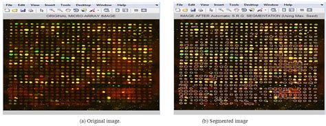 fully automated adaptive shape segmentation method for noisy complenentary dna microarray images