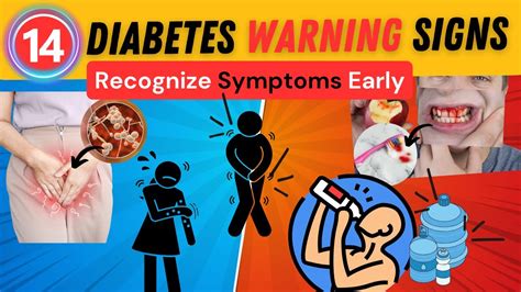 14 Diabetes Dangerous Signs You Don T Ignore Symptoms Signs