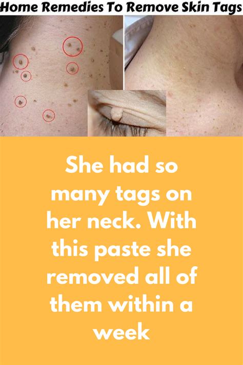 She Had So Many Tags On Her Neck With This Paste She Removed All Of