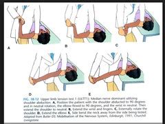 Neurodynamics Tension Tests Upper Limb Tension Test ULTT Quizlet