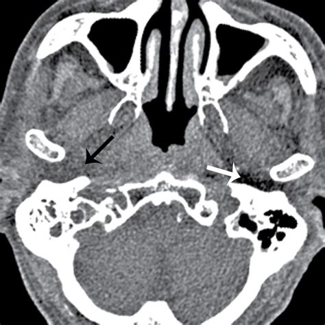 Temporal Bone Imaging Radiology Key