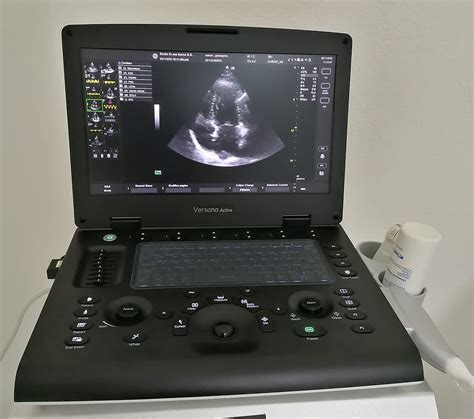 L Ecocardiogramma Color Doppler Cos E A Cosa Serve