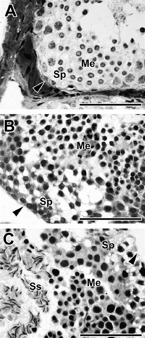Cross Section Of Seminiferous Tubules Showing Individual Variation