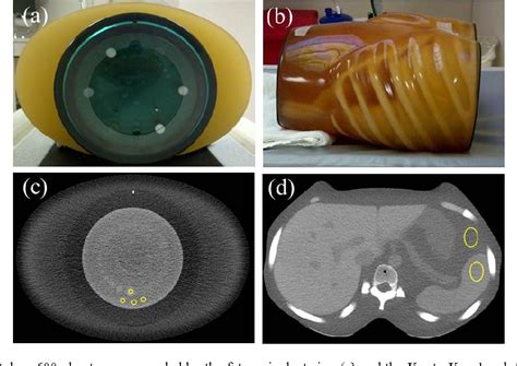 figure 1 from performance evaluation of iterative reconstruction algorithms for achieving ct
