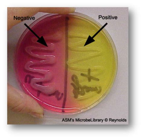 Microbiology Lab Final Flashcards Quizlet