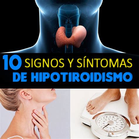 10 signos y síntomas del hipotiroidismo La Guía de las Vitaminas