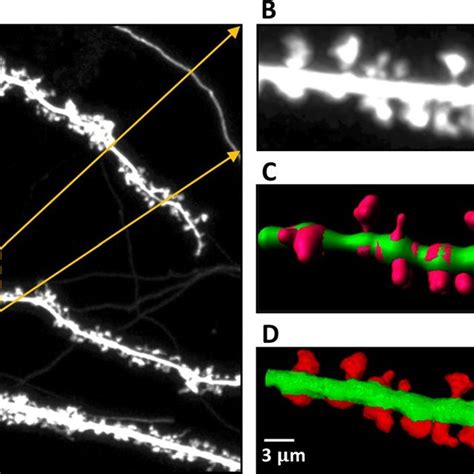 segmentation of dendritic spines from complex dendritic tree in brain download scientific