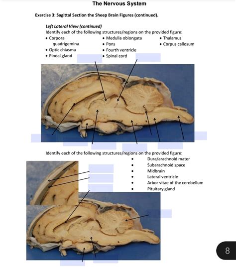 Sheep Brain Sagittal View