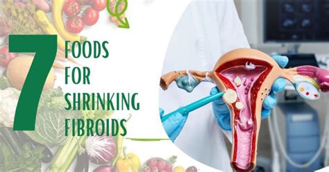 Powerful Foods For Shrinking Fibroids Naturally Healthiast