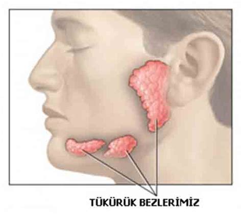 Tükürük Bezi Şişmesi Belirtileri ve Tedavisi