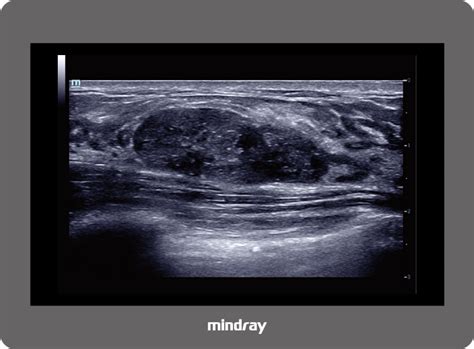Mindray RESONA 6 COMAMED
