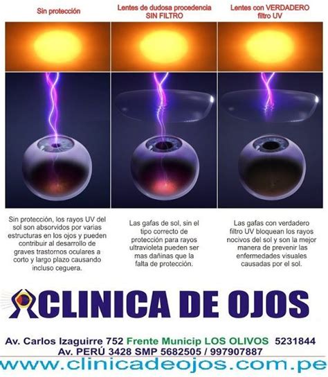 Cl Nica De Ojos Oftalmic L Ser Filtro Uv Actividades Del Cuerpo
