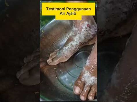PENGOBATAN LUKA BOROK DENGAN AIR AJAIB ALHAMDULILLAH 2 HARI LANGSUNG