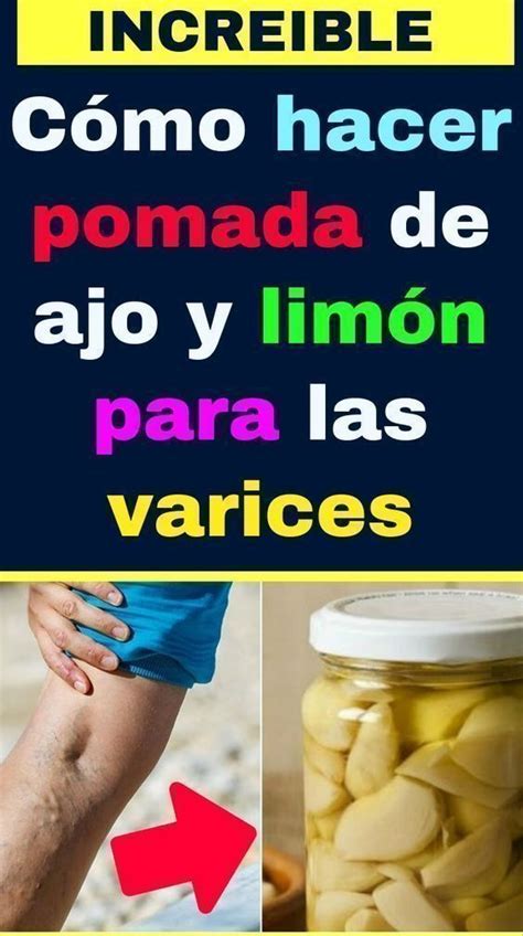 Cómo hacer pomada de ajo y limón para las varices Recipes