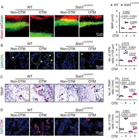 Using Inducible Osteoblastic Lineage Specific Stat3 Knockout Mice To