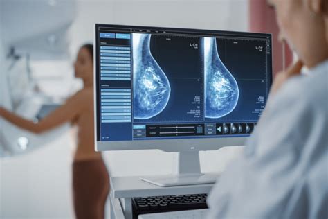 Cancer Du Sein Ce Qu Il Faut Savoir Sur Le Nouveau Traitement Trodelvy