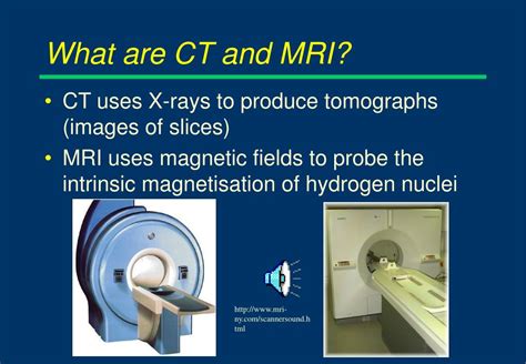 PPT Applications Of Magnetic Resonance Imaging MRI And Computed