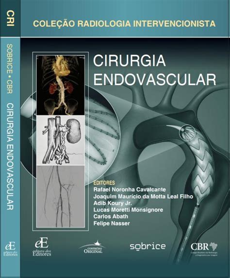 Cirurgia Endovascular Editora Dos Editores