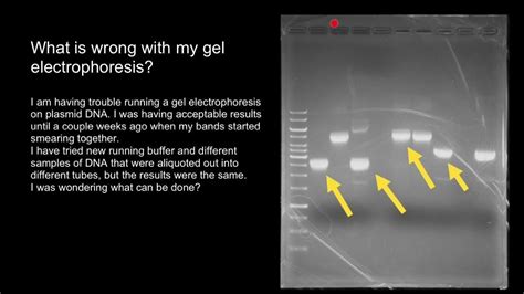 Agarose Gel Electrophoresis Is A Molecular Biology Method To Analyze