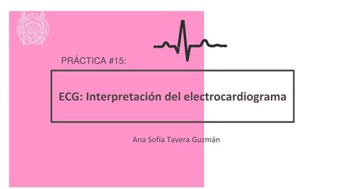 EKG Interpretación Básica del Electrocardiograma Ana Sofía Tavera