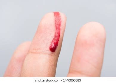 Bleeding Blood Cut Finger Wound Injured Stock Photo Edit Now 1440000383