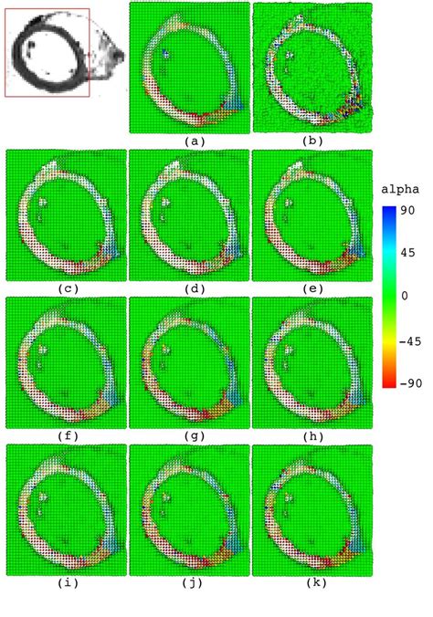 7 regularization results on a real dataset acquired with the protocol download scientific