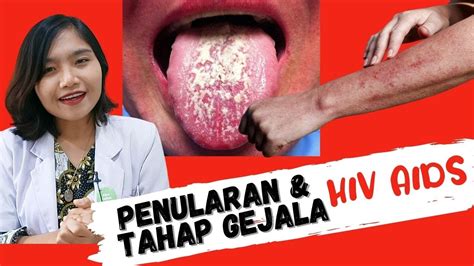 HIVAIDS 1 Penularan Dan Tahap Gejala HIV AIDS Dr Ema Surya P
