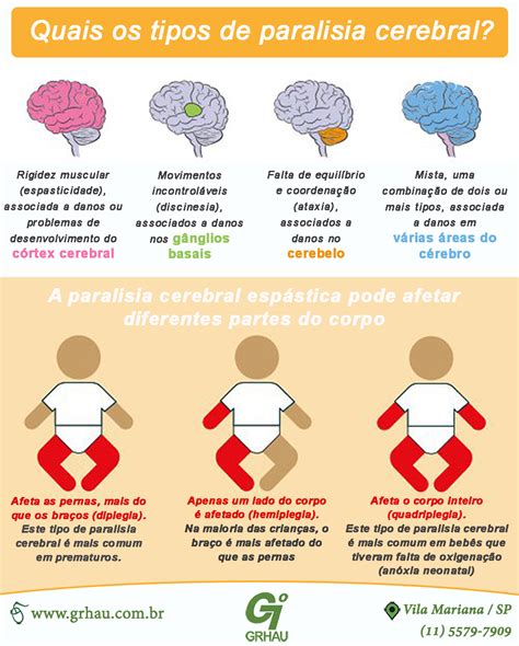 Psicopedagogia E Psican Lise Diadema Paralisia Cerebral
