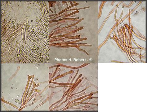 Microscopie Basides De Calocera Viscosa J Rossi B Clesse H Robert
