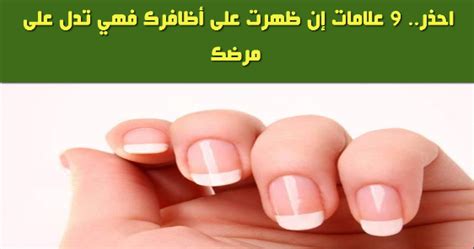احذر 9 علامات إن ظهرت على أظافرك فهي تدل على مرضك