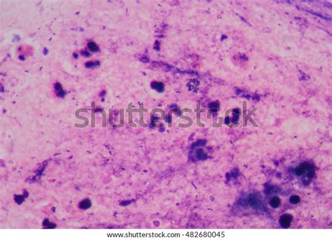 Gram Staining Called Grams Method Method Stock Photo