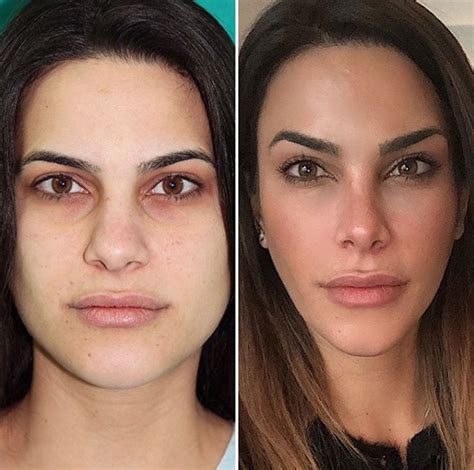 Carla Barber nos muestra el antes y el después de su cara