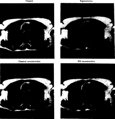 figure 1 from fast segmented image coding using weakly separable bases semantic scholar