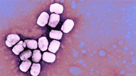 Viruela por qué todavía se guardan dos muestras del virus que produce