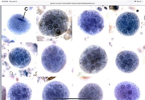 Parasitology Lab Practical Flashcards Quizlet