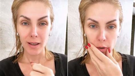 Ana Hickmann terá medida protetiva contra marido mesmo contra sua vontade