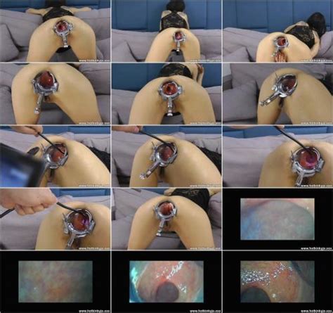 HotKinkyJo XO Speculum And Deep Anal Abbys Travel With Endoscope