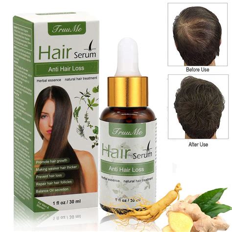 Sint Tico Foto Como Hacer Crecer El Cabello R Pido Hombres En