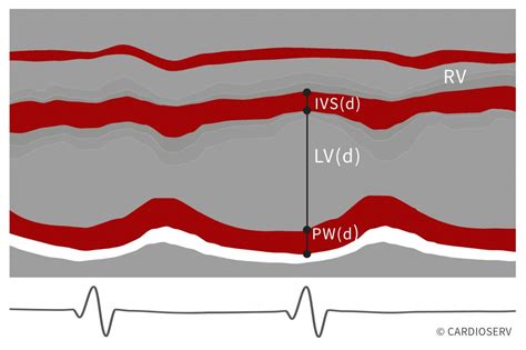 Lv Mass Measurement Echo Semashow
