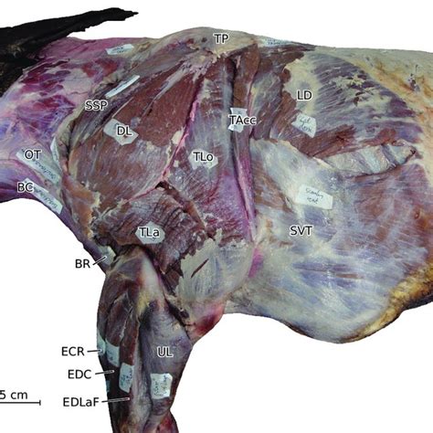 Photograph Of The Dissection Of The Superficial Muscles Of The Left