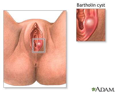Comida Inspector Soldado Labial Abscess Discrepancia Labe Confidencial