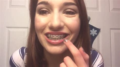 Erica S Braces Erica Showing A Close Up Of Her Braces Kaz Miller