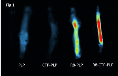 Lipid Nanoparticles Functionalized For Sub Endothelial Matrix