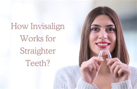 How Invisalign Works For Straighter Teeth Beyondpsychub