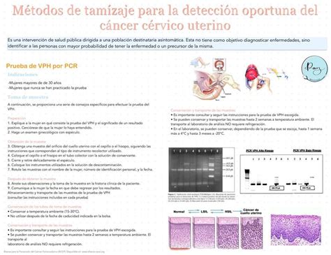 M Todos De Tam Zaje Para C Ncer C Rvico Uterino Pauztudy Paulina