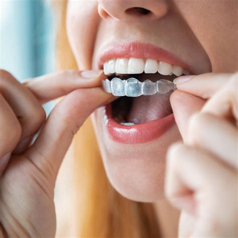 Invisalign In Houston TX Smile Unique Dentistry