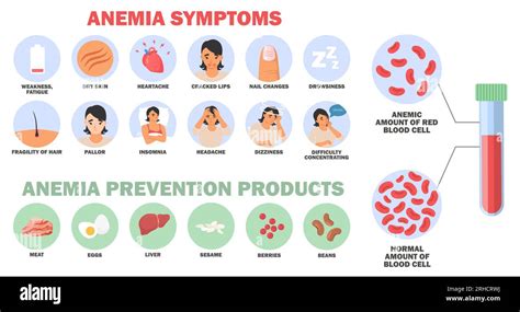 Anemia Symptoms And Prevention Products Info Graphic Stock Vector Image
