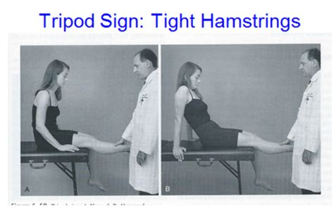 Le Ortho Tests Flashcards Quizlet