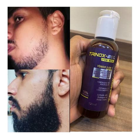 Produto Para Crescer Barba E Cabelo Preenche Falhas Un