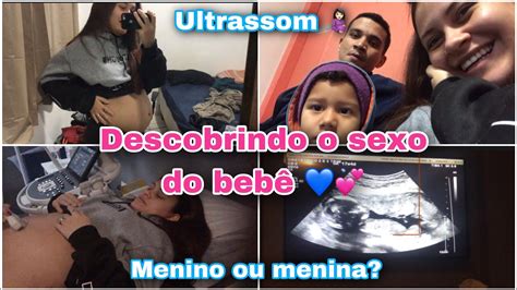 Vlog Descobrindo o sexo do bebê pelo ultrassom 17 semanas e 4 dias